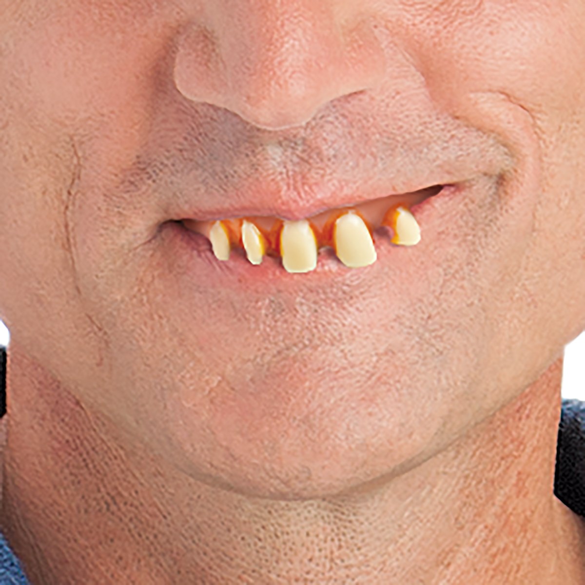 Billy Bob Goofy Hillbilly Redneck Halloween Teeth | Collections Etc.